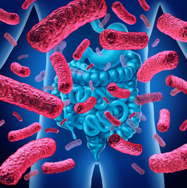 The Leaky Gut-Autoimmune Disease Connection - Dr Becky Campbell