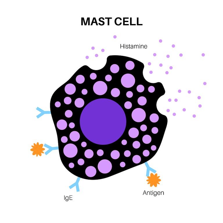 Mast Cell Activation Syndrome (MCAS): Symptoms, Causes, and Solutions ...