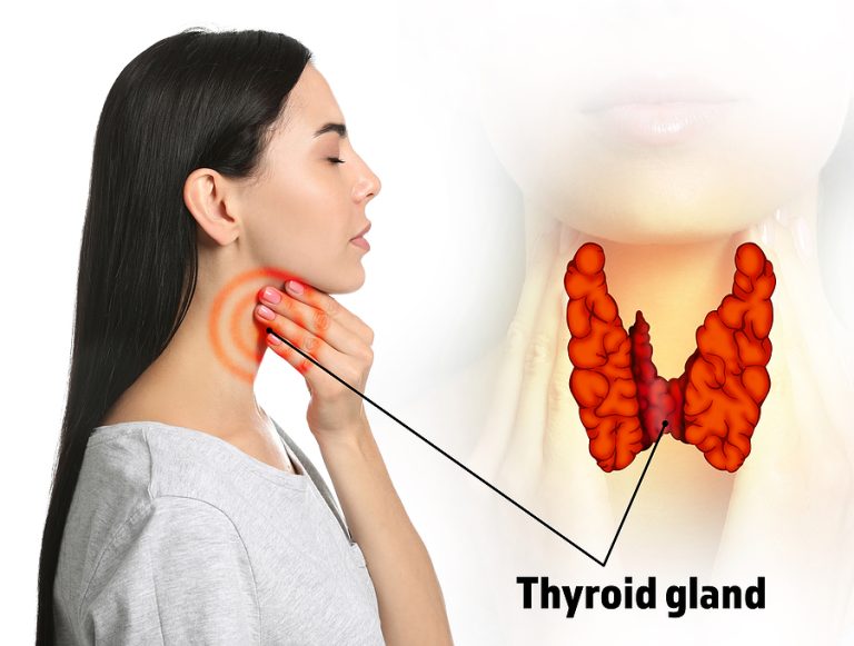 Your Thyroid and Mast Cells: The Connection - Dr Becky Campbell